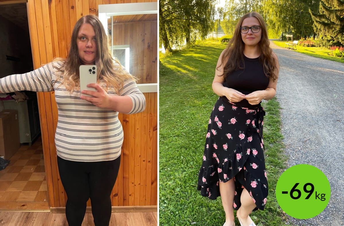 Kristiina: Maovähendusoperatsioon jäi ootele, dieediga kadus 69kg